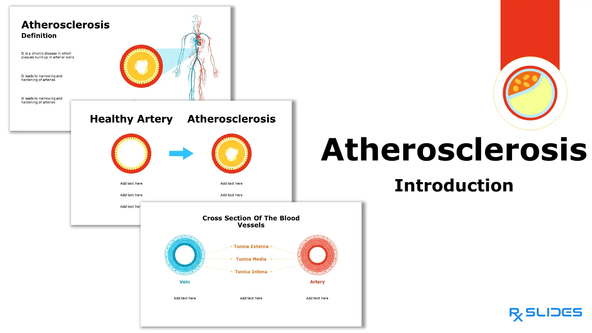 Download Atherosclerosis PowerPoint Template| RxSlides